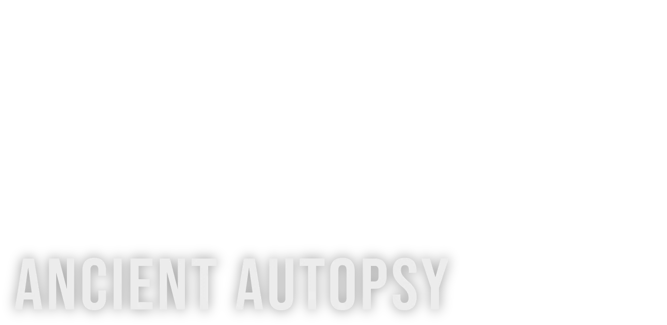 Watch Ancient Autopsy | Stream free on Channel 4